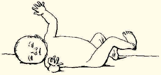 Reflexul Moro la nou-nascuti